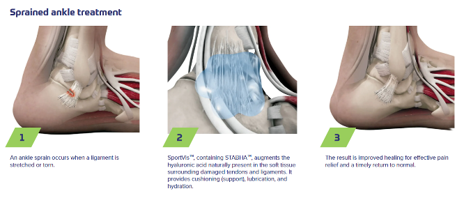 SportVis – Ontario Regenerative Medicine
